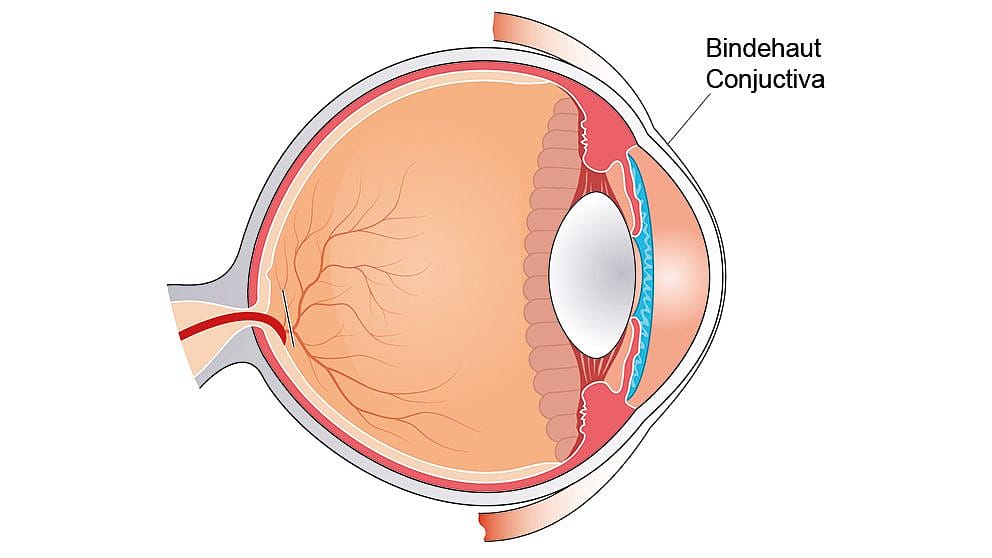 Bindehautentzündung – Ursachen, Symptome & Behandlung | Weleda®